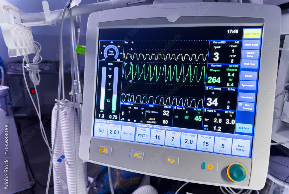 Hospital monitor displaying vital signs: heart rate, blood pressure ...