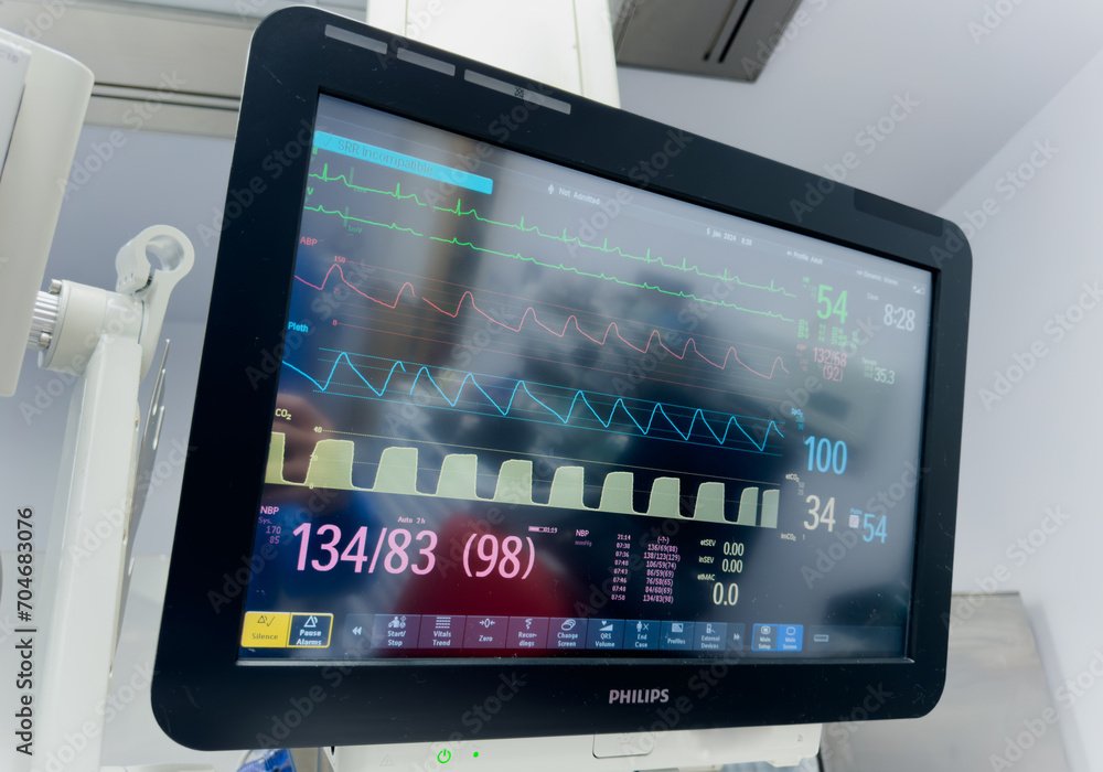 Hospital monitor displaying vital signs: heart rate, blood pressure ...