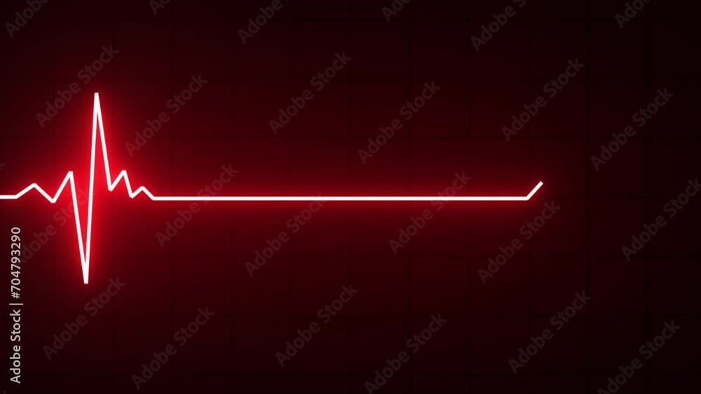 Glowing red neon Heart pulse monitor with signal. Electrocardiogram ...