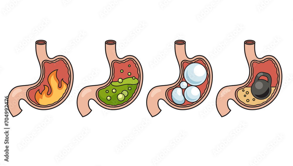 Stomach disease. Heaviness in the stomach, bloating, increased acidity ...