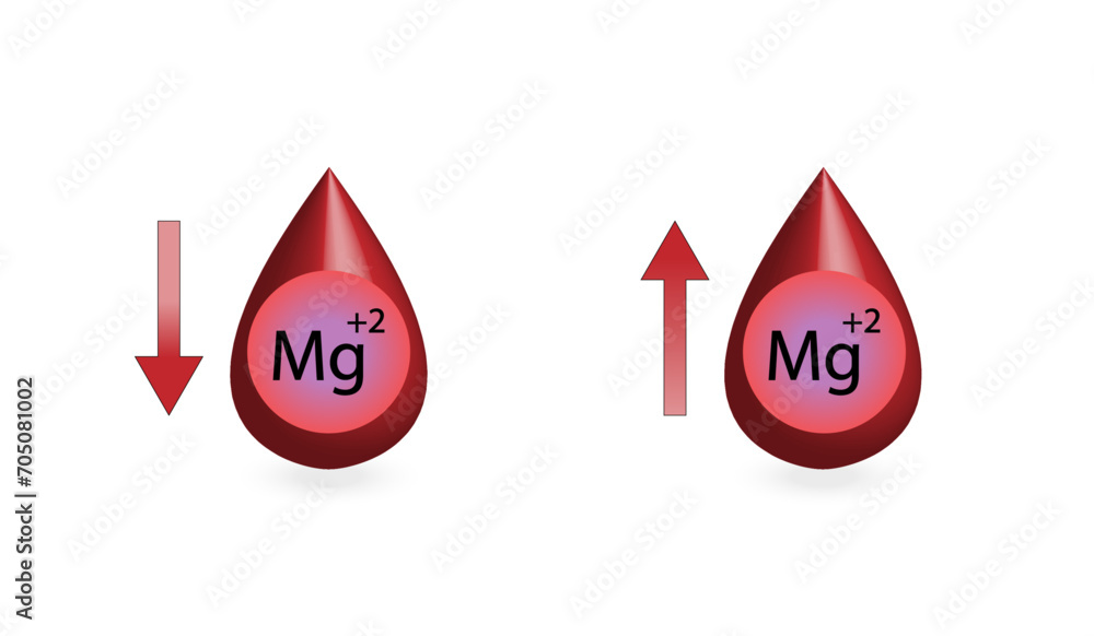 hypermagnesemia, high plasma magnesium level and hypomagnesemia, low ...