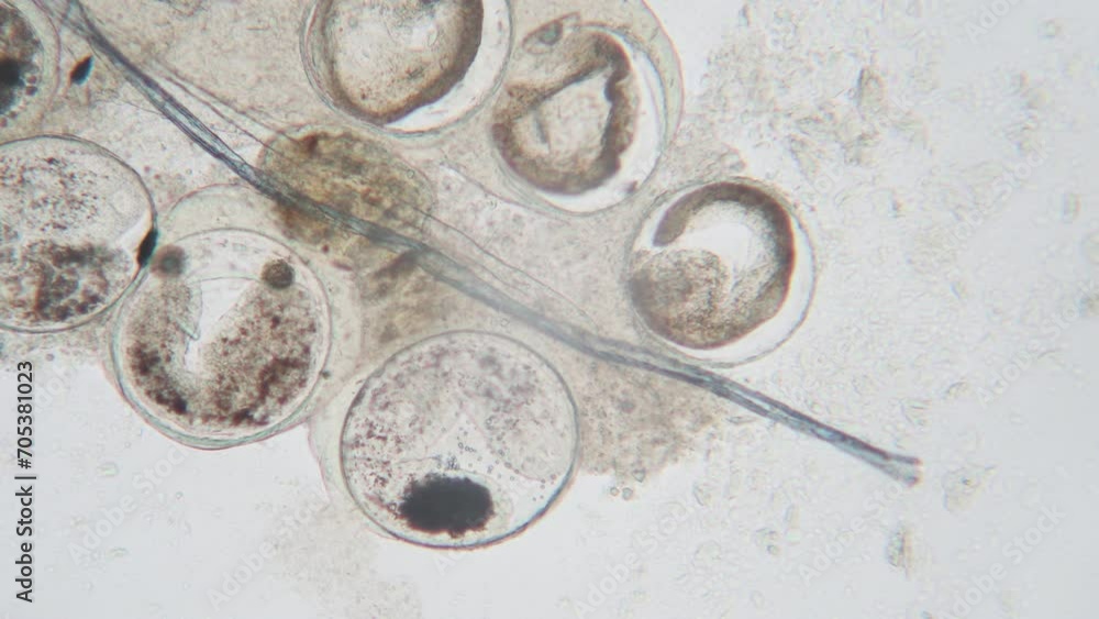 Vidéo Stock Study of Parasitic helminths (Trematodes) of marine fishes ...