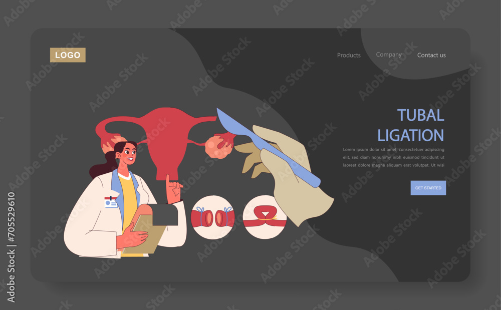 Types of Contraception. Doctor explains tubal ligation as a permanent ...