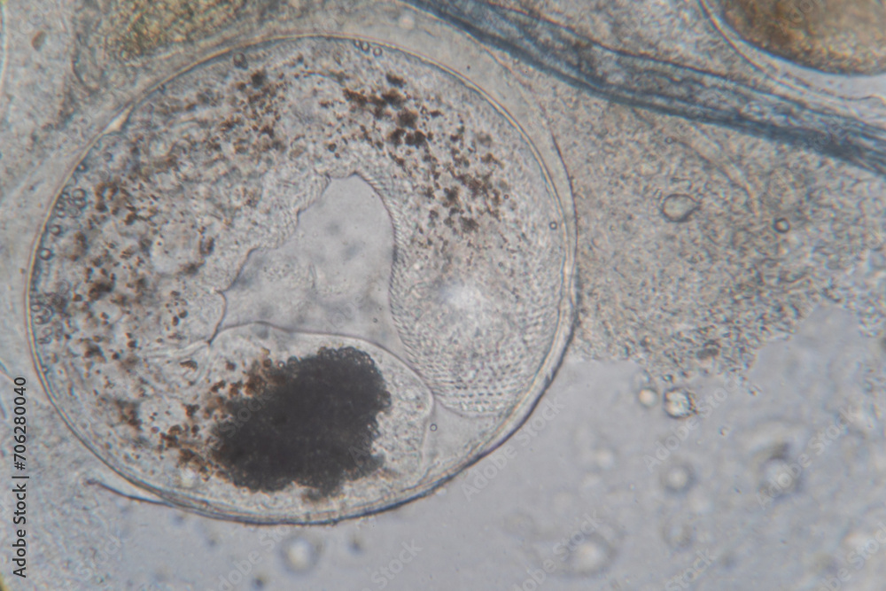 Study of Parasitic helminths (Trematodes) of marine fishes under a ...