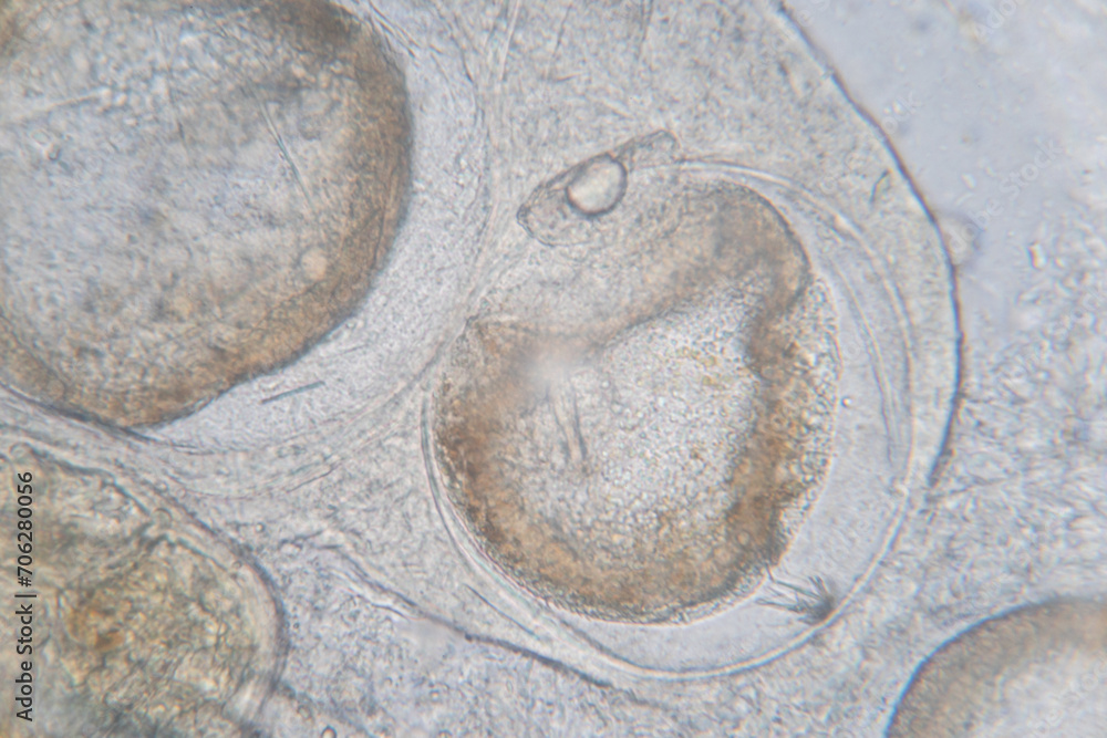 Study of Parasitic helminths (Trematodes) of marine fishes under a ...