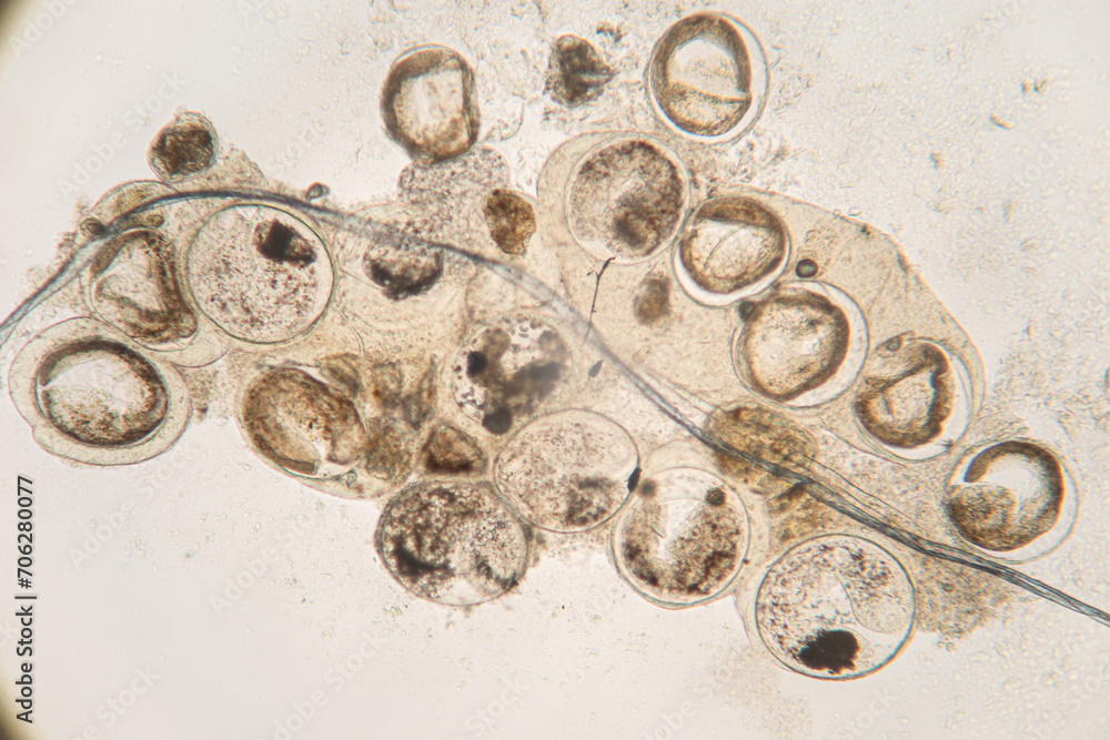 Study of Parasitic helminths (Trematodes) of marine fishes under a ...