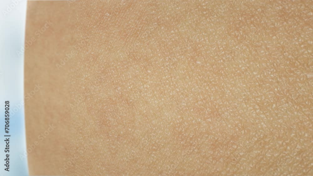 3D animation Face close-up repair effect skin dirt removal. Deep ...