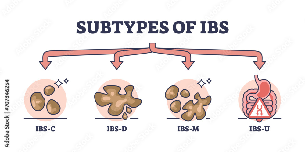 Subtypes of IBS or irritable bower syndrome classification outline ...