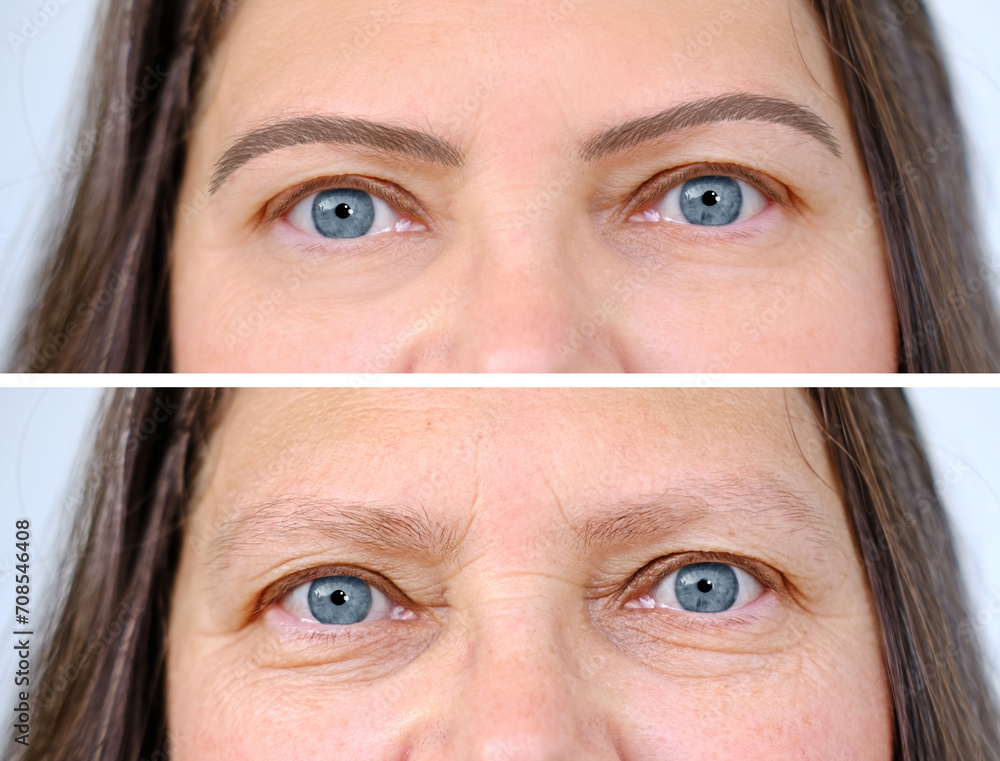 close up part of mature woman 50 years old, human face, wrinkles around ...