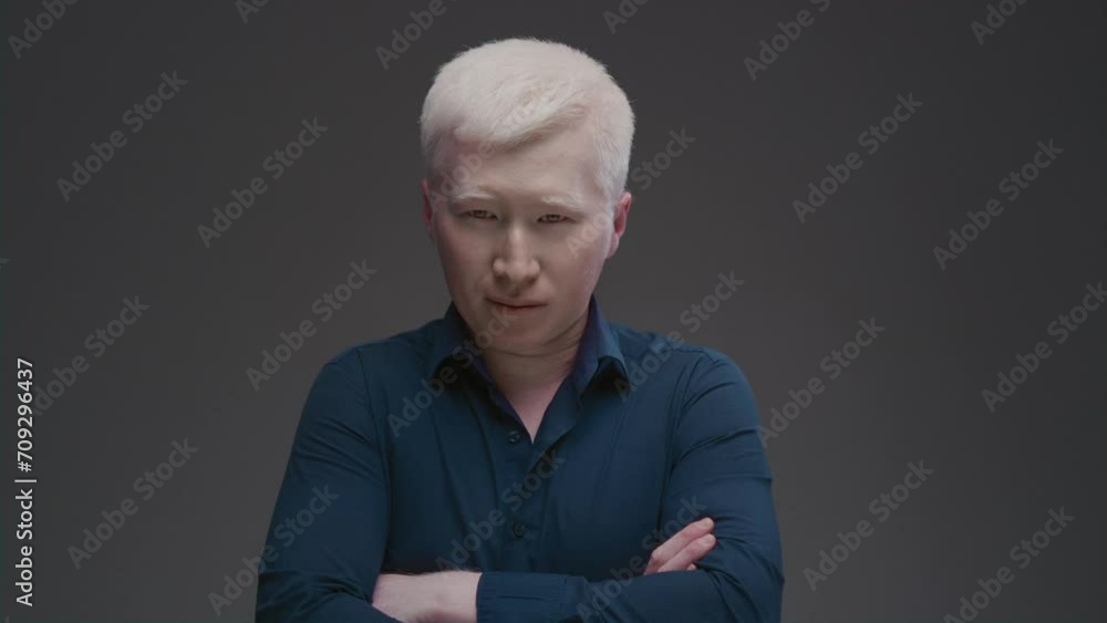 Vidéo Stock Portrait of an Asian albino guy. Eastern man with a genetic ...