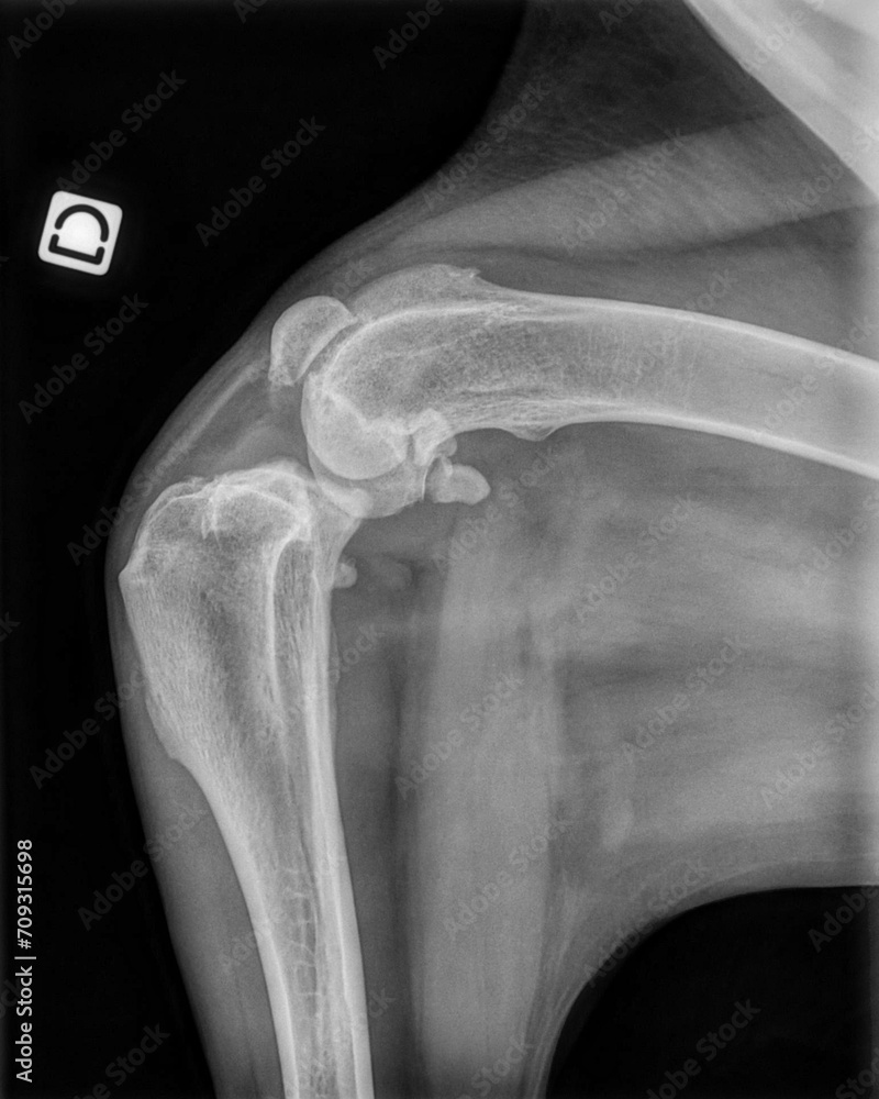 X-ray of a Saint Bernard dog's knee with a torn anterior cruciate ...