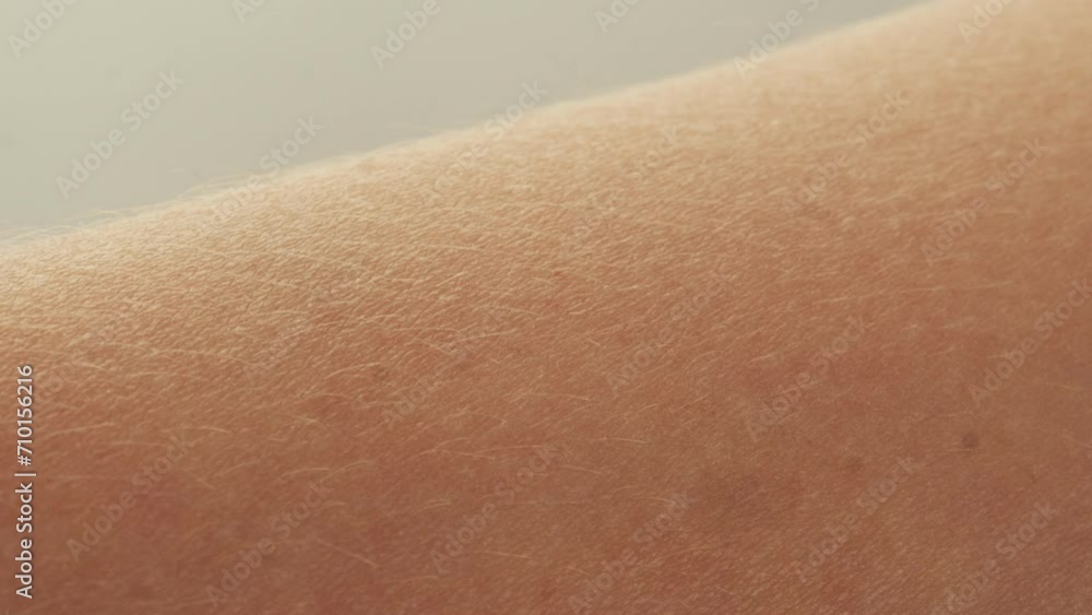 Hand surface with hair close-up. Human skin reaction to cold or fear ...