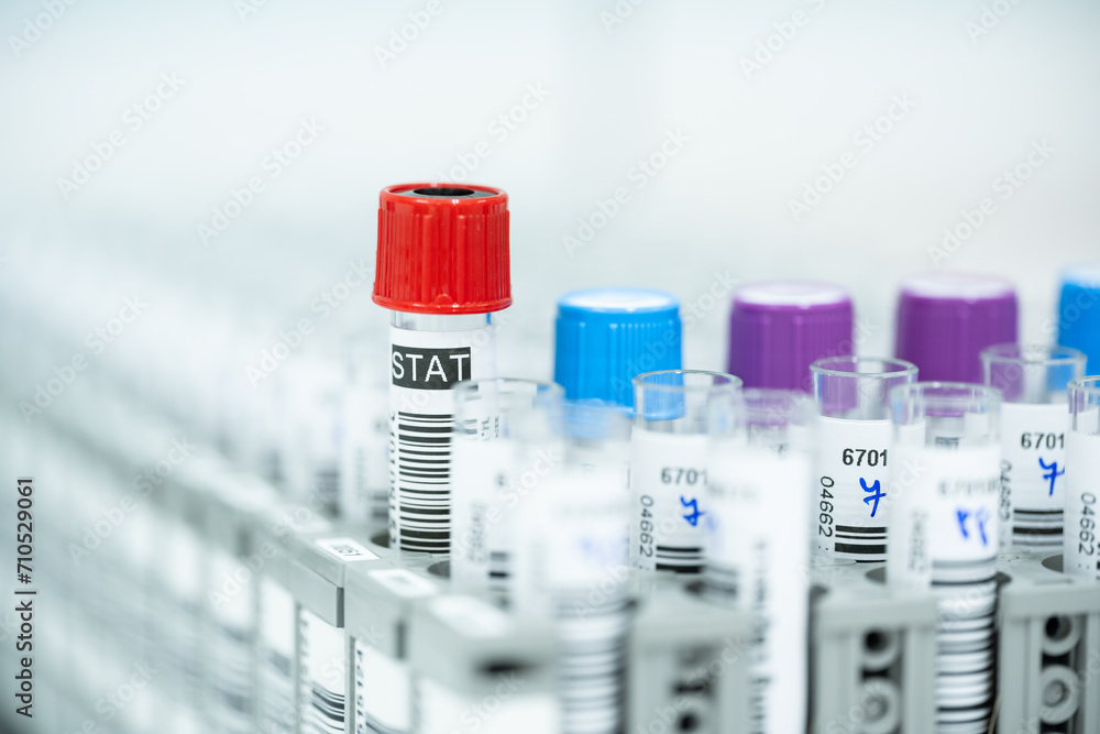 Blood test tube isolated and barcode label on white background ...