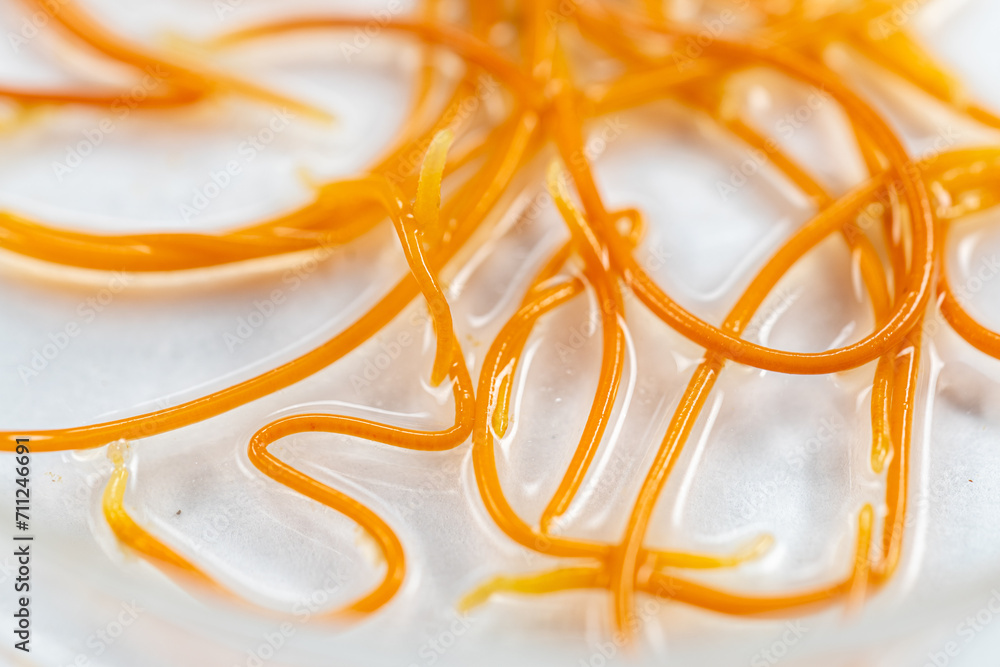 Study of Parasitic helminths (Trematodes) and Ascaris of fishes under a ...