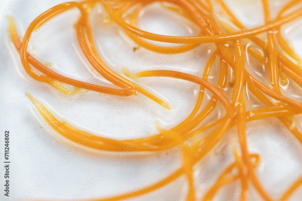 Foto de Study of Parasitic helminths (Trematodes) and Ascaris of fishes ...