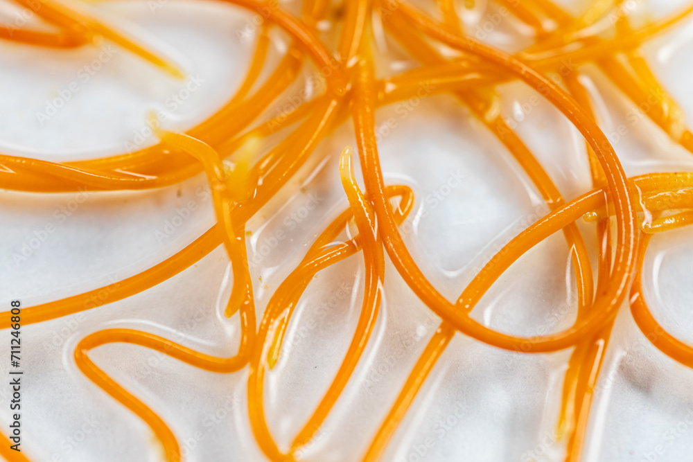 Study of Parasitic helminths (Trematodes) and Ascaris of fishes under a ...