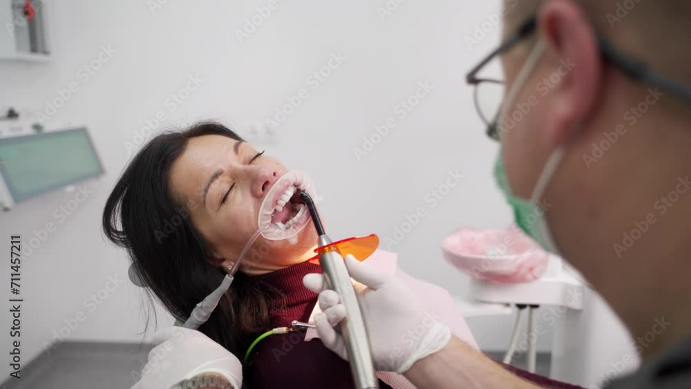 Vidéo Stock Dentist bonding woman's veneers, ceramic crowns on teeth ...
