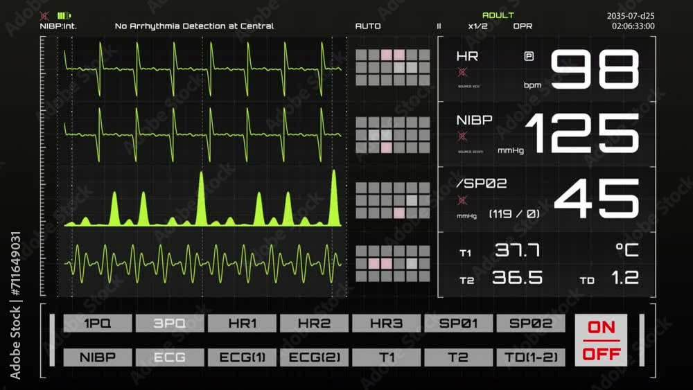 Vital Signs Monitor with Heart Rate and Other Medical Parameters on an ...