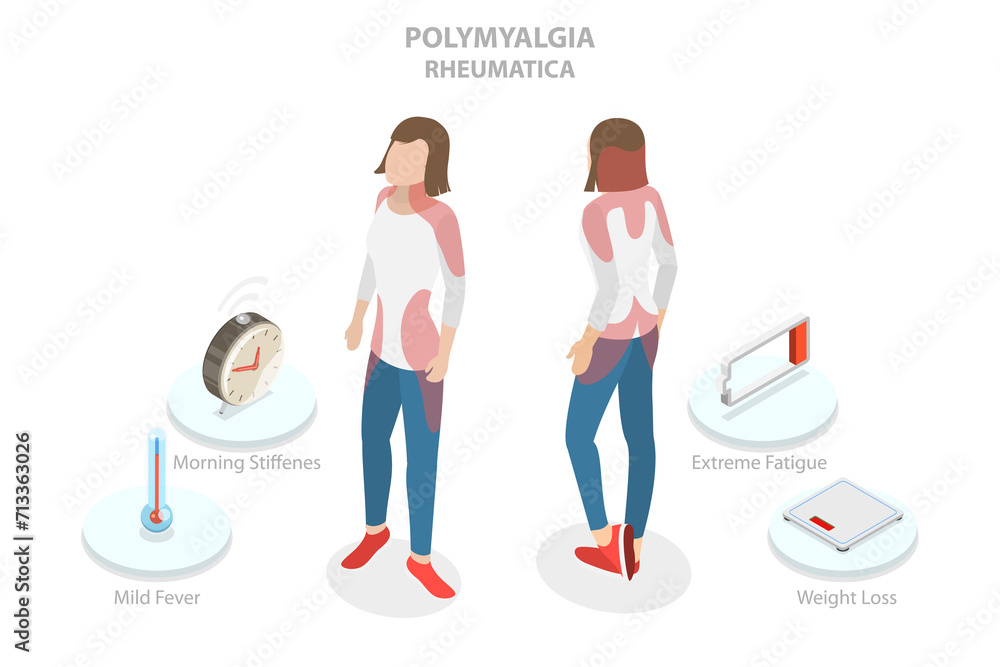 3D Isometric Flat Conceptual Illustration of Polymyalgia Rheumatica ...