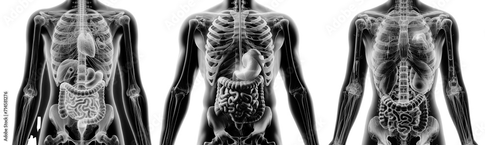 Transparent Background Black white X-ray upper body human body Male ...