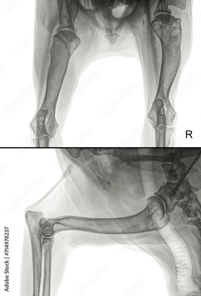 Above a dorso-ventral X-ray of the head of the right (R) humerus of a ...