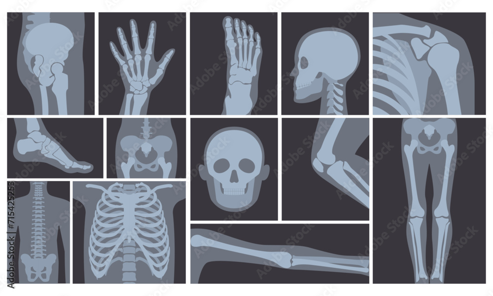 Vector illustration of realistic set of many X-rays pictures of human ...