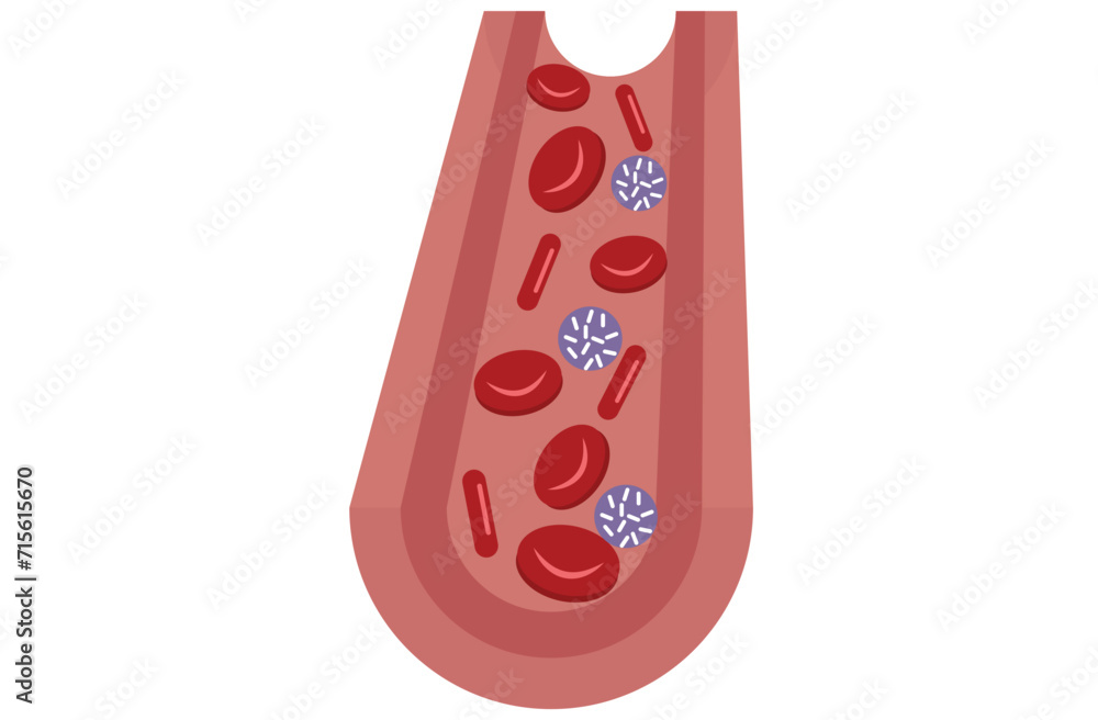 leukemia. Blood cancer. Red and white blood cells. Isolated vector ...