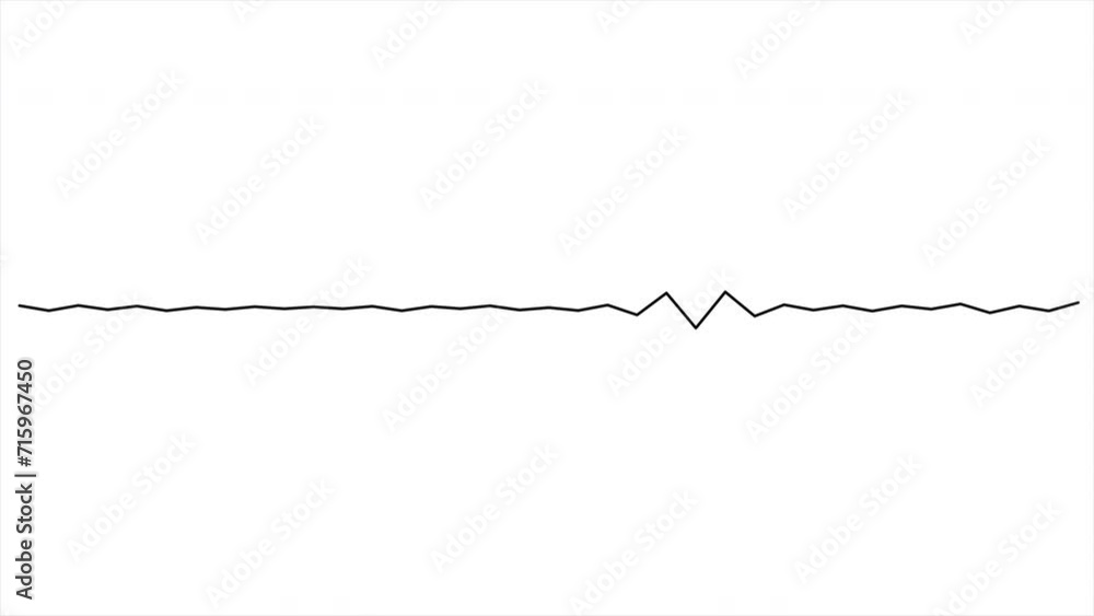 Motion sign of sound modulation recording, thin black line showing ...