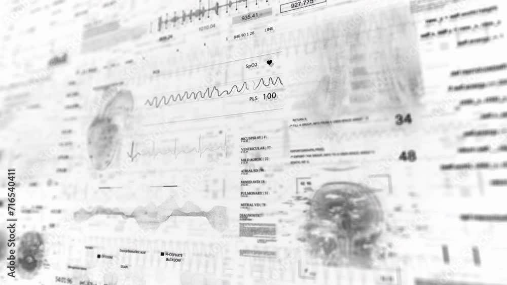 Abstract UI MRI x ray Scan.Heart rate monitor. Medical UI HUD ...