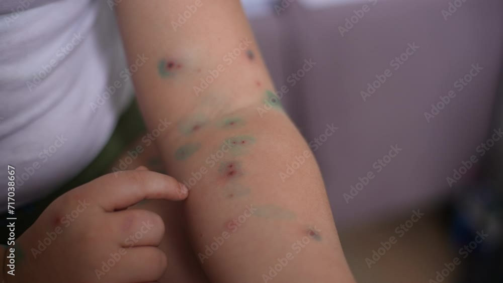 Vidéo Stock Close-up cropped shot of unrecognizable sick child boy ...