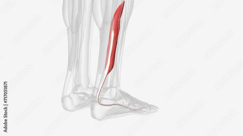 The flexor hallucis longus muscle (FHL) attaches to the plantar surface ...
