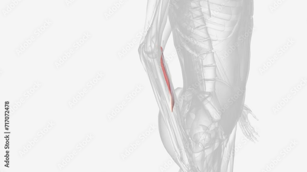 The pronator teres muscle is a long, round muscle that is located on ...