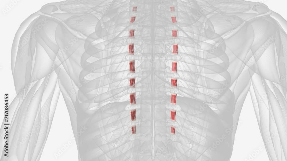 The thoracic subdivision has unpaired intertransversarii muscles ...