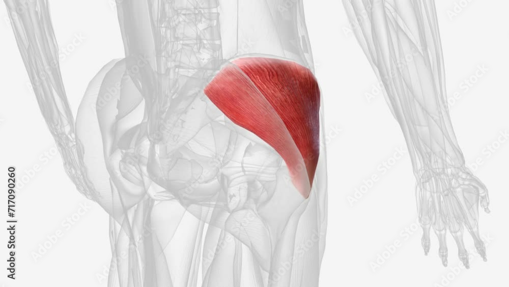 The gluteus medius, one of the three gluteal muscles, is a broad, thick ...