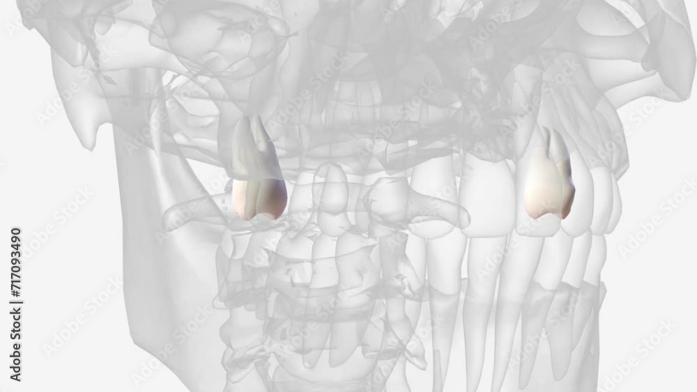 The maxillary third molar is the most distal tooth in the arch and ...
