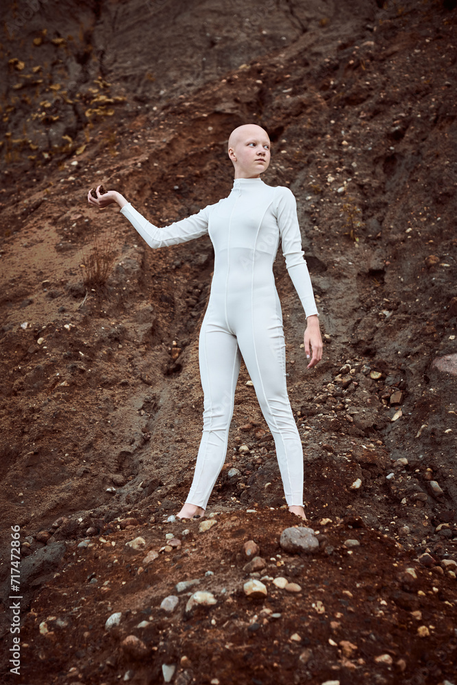 Full length portrait of young hairless girl with alopecia in white ...