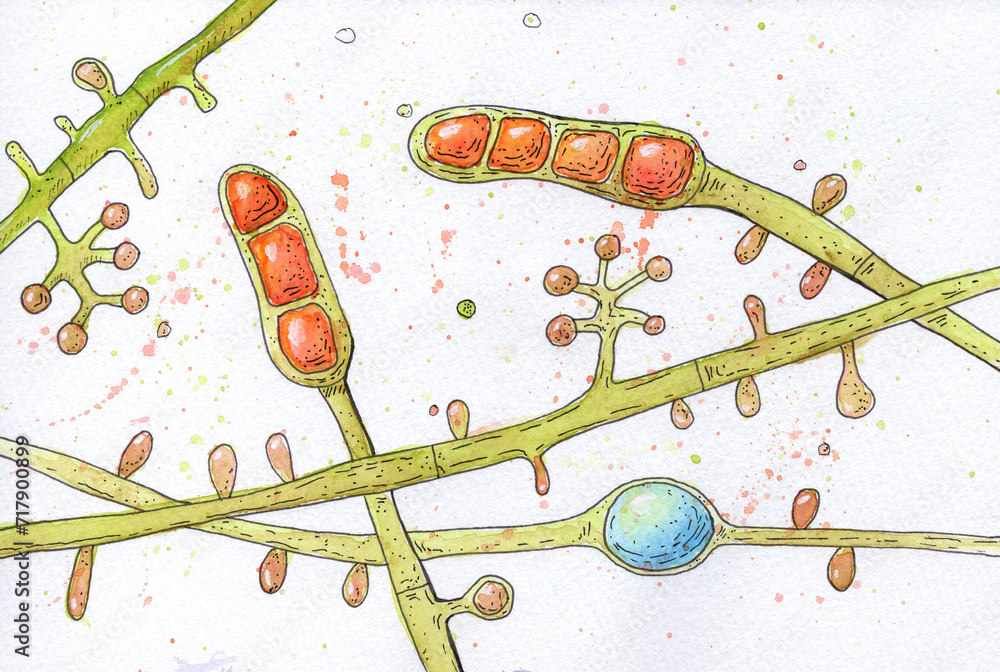 Hand drawn watercolor illustration of Trichophyton tonsurans fungi ...