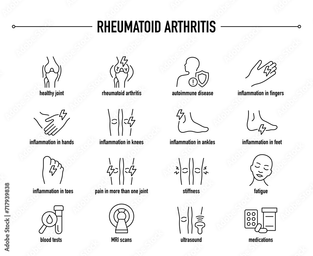 Rheumatoid Arthritis symptoms, diagnostic and treatment vector icons ...