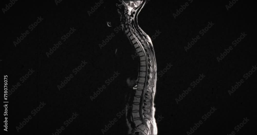 Grungy and highly textured vintage MRI scan of multiple smaller scans ...