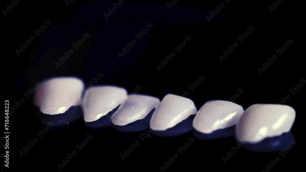 Vidéo Stock A macro shot of dental veneers. Veneers are special tooth ...