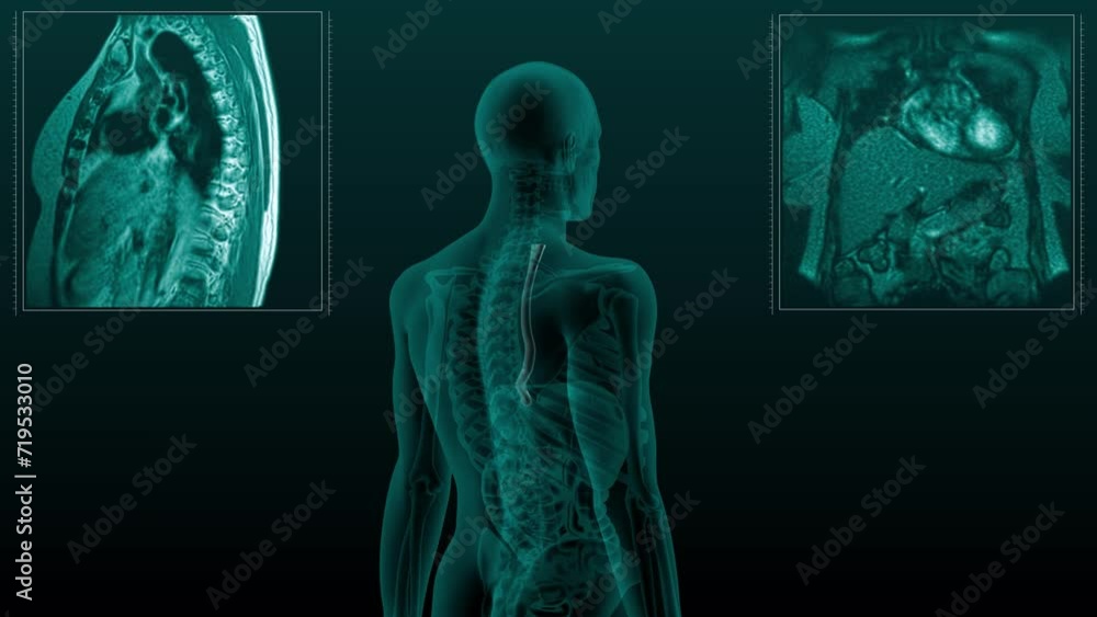 Magnetic resonance tomography scan of the human digestive system ...