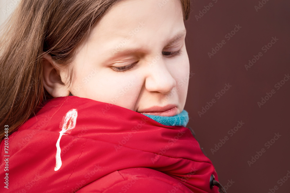Bird Droppings or Fresh Bird's Shit on Girl Jacket. Bird Poop ...