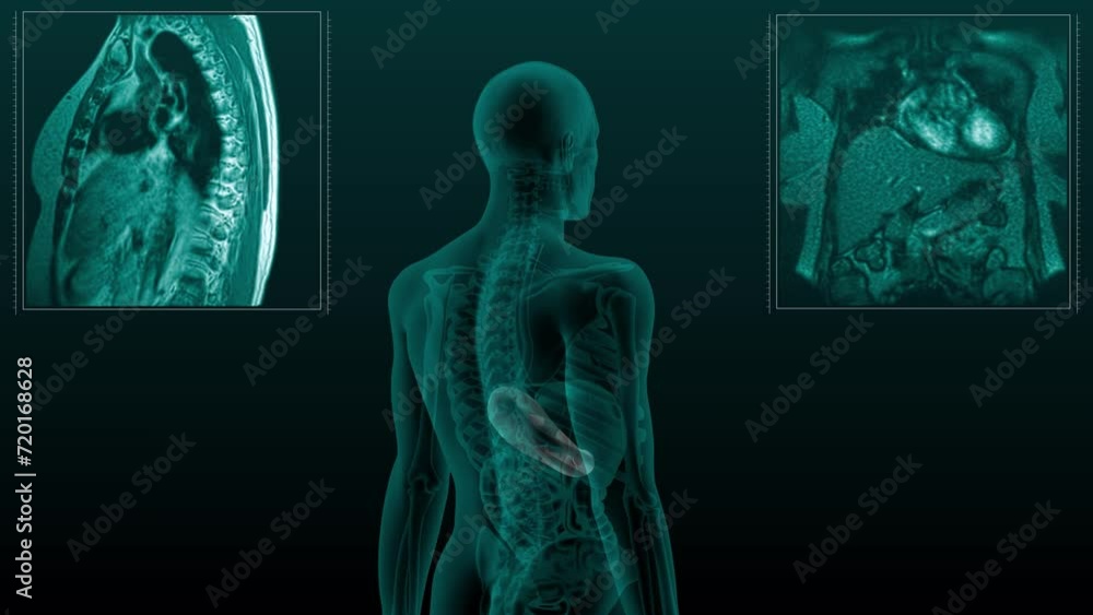 Stockvideon Magnetic resonance tomography scan of the human digestive ...