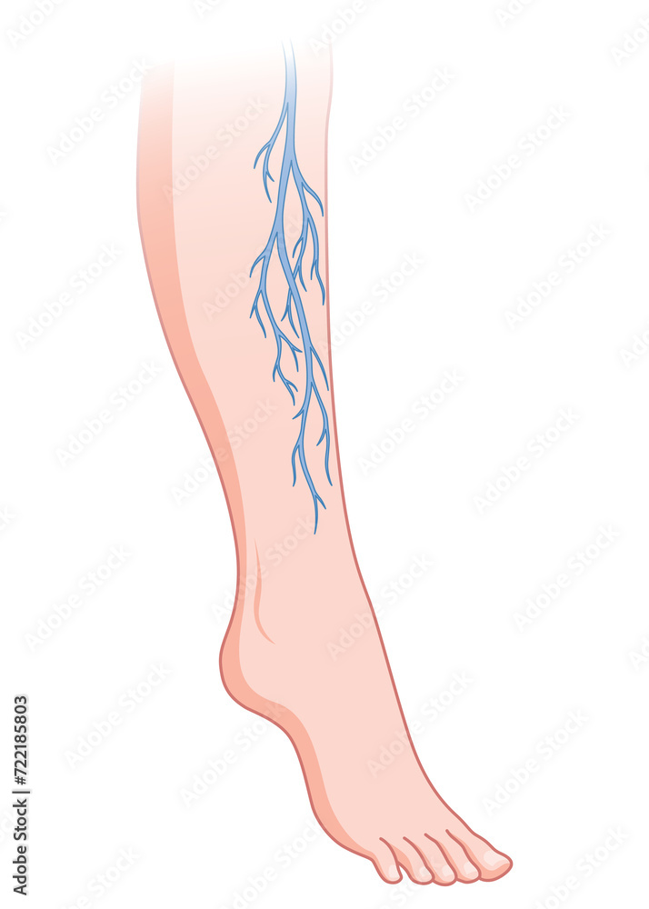 Varicose veins. Blue blood vessel visible through the skin, abnormally ...