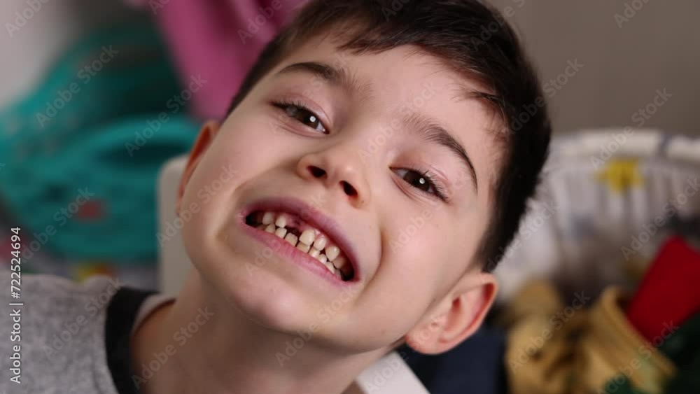 cute preschool boy with one milk teeth missing.smiling child close up ...