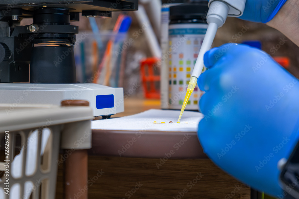 Doctor dripping urine from a pipette onto test strip test or labstix ...