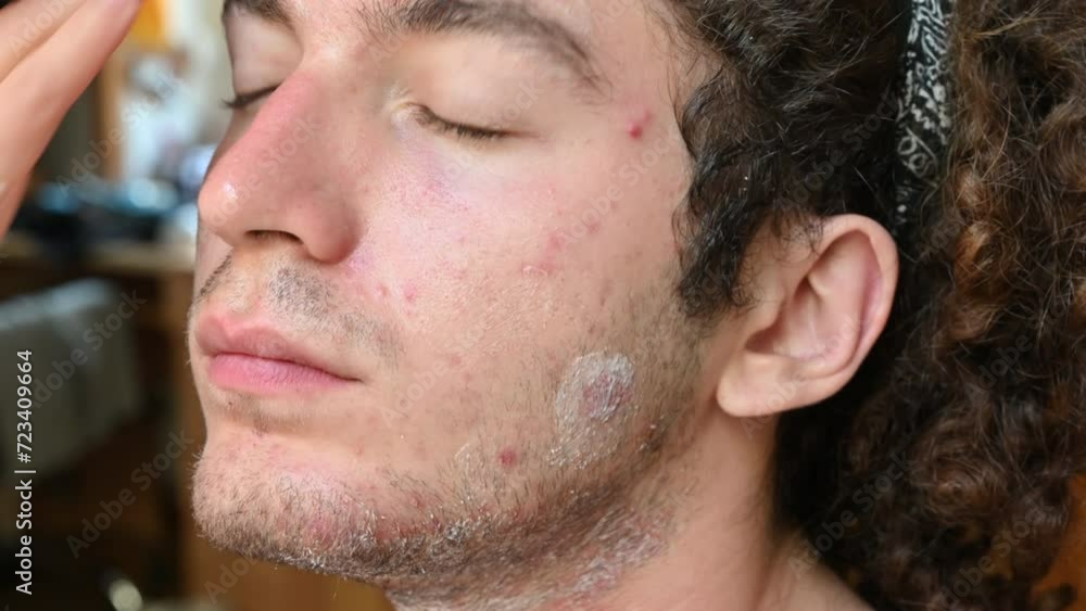 Footage with a portrait of the face of a young Caucasian man suffering ...