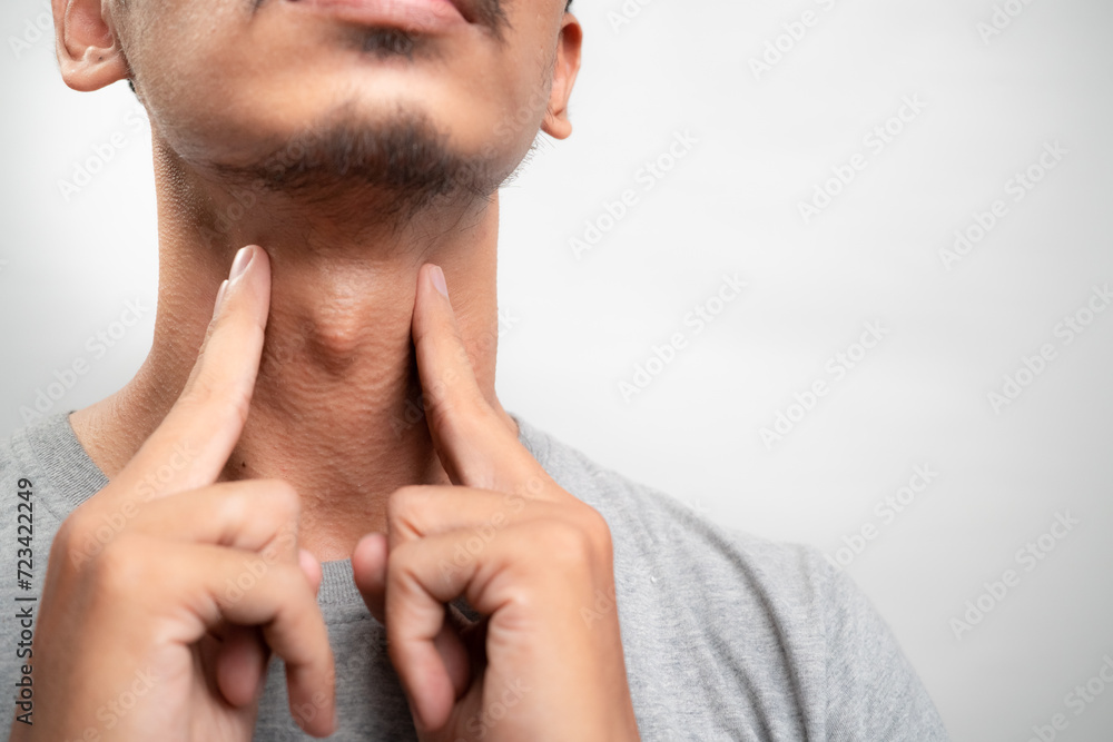 Inflammation of the thyroid gland, sore throat and cough, man with neck ...