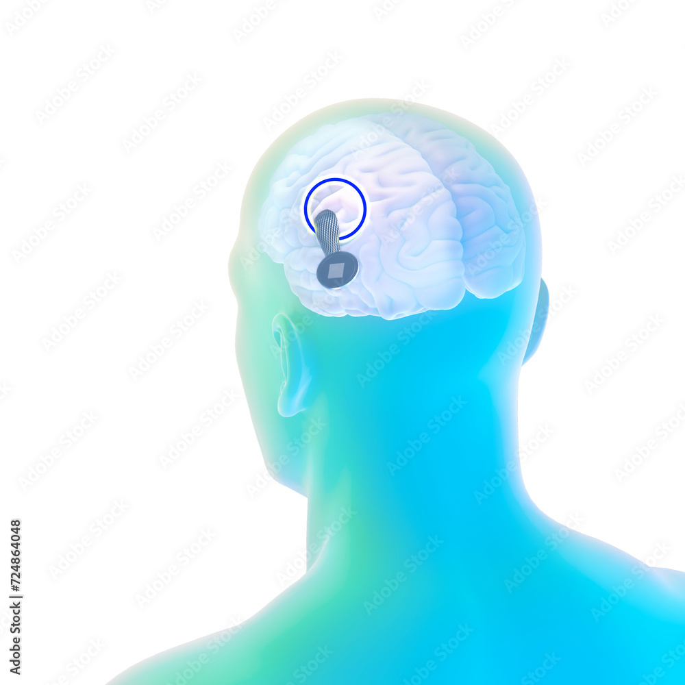 Link, neuralink, new artificial intelligence technology that allows you ...