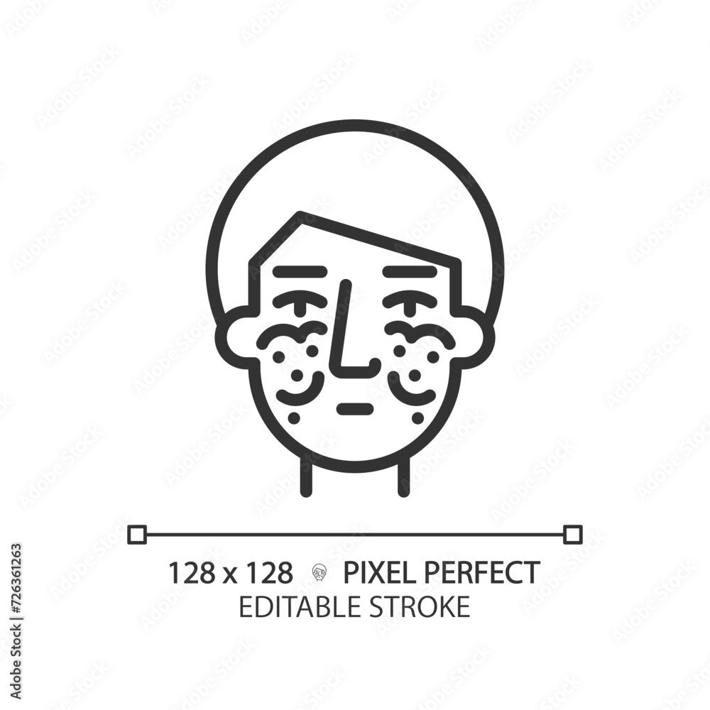 Lupus rash linear icon. Erythema chronic illness. Life expectancy ...